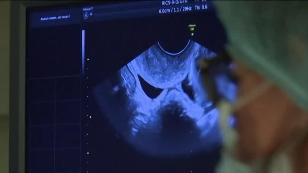 WHO Infertility report: One in six people experience infertility ...