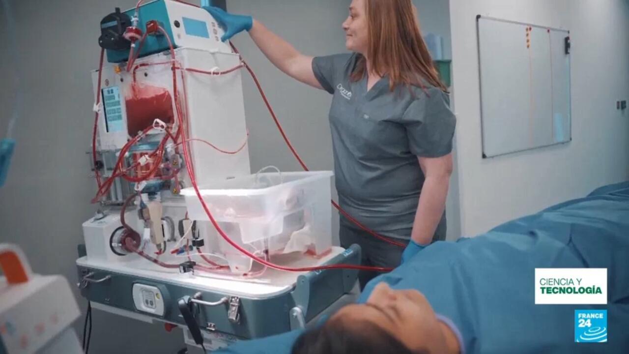 OrganOx, la revolución que alarga la vida de órganos para trasplantes ...