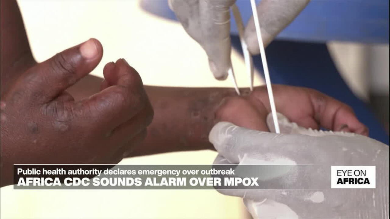 Africa Centres for Disease Control sounds alarm over mpox outbreak ...