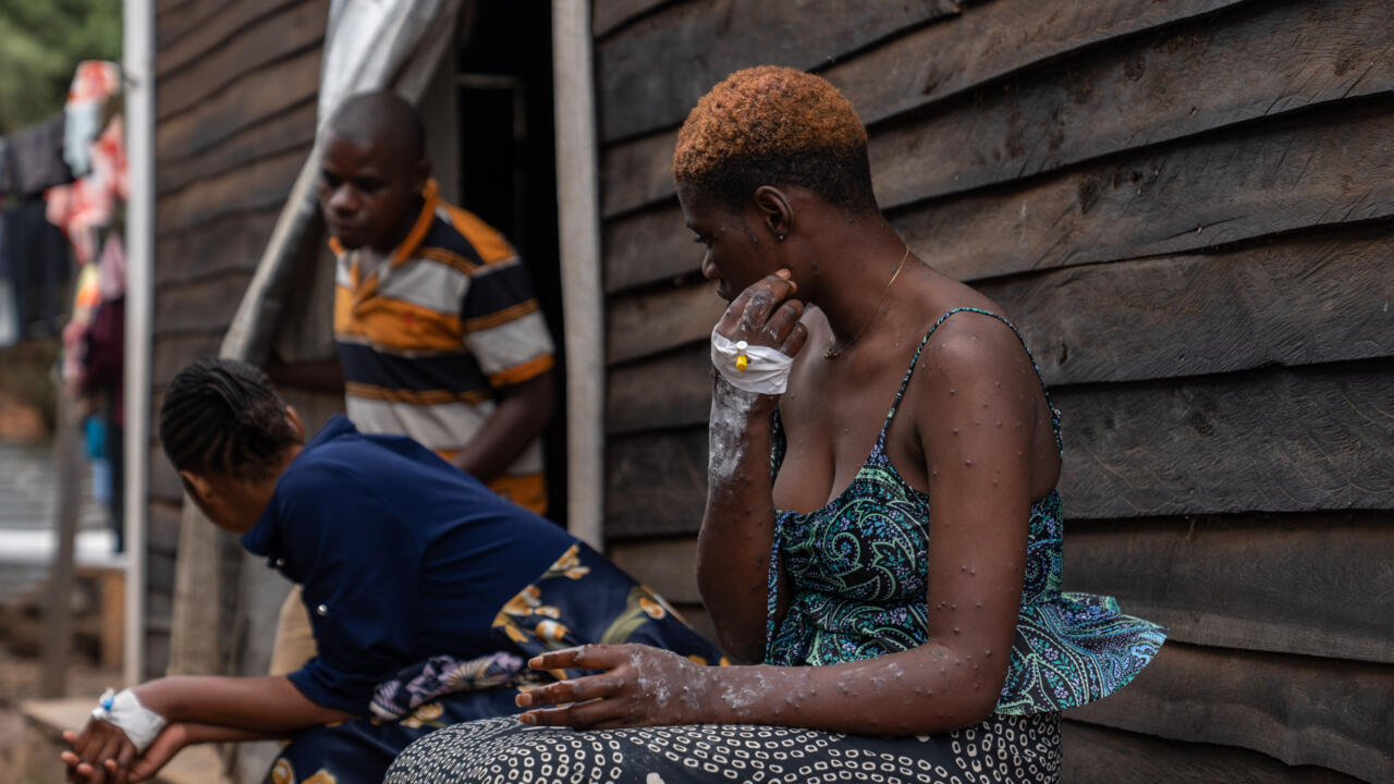 Mpox : l'OMS annonce des vaccins en République démocratique du Congo ...