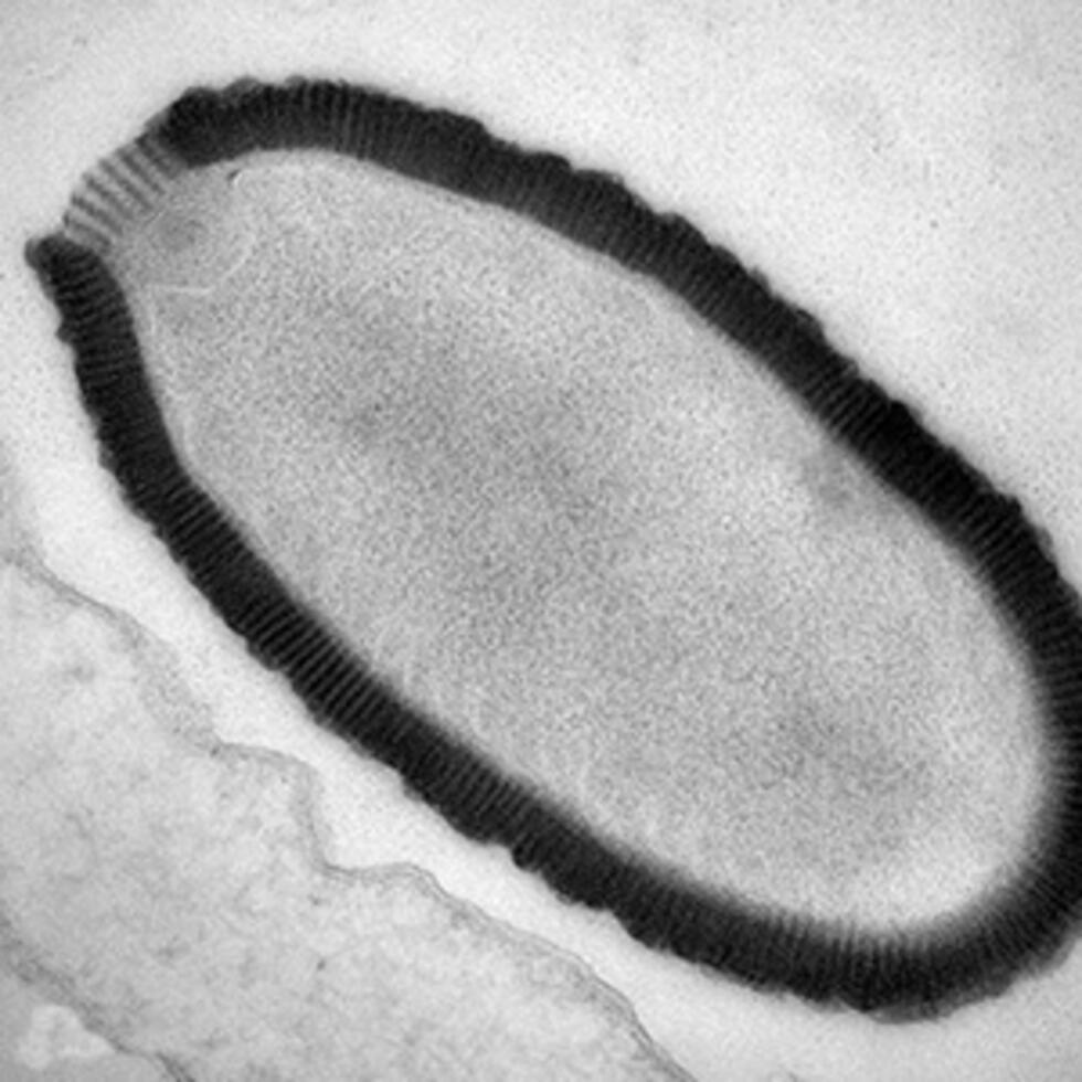 Le pithovirus, cet agent infectieux venu du froid