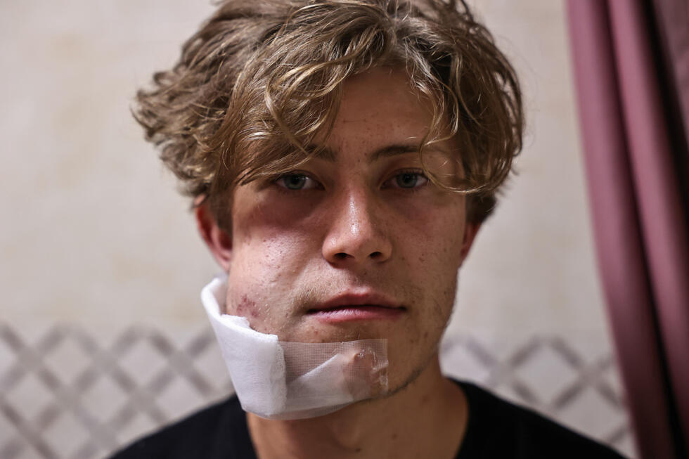 Israeli settlers beat foreign volunteers in occupied West Bank