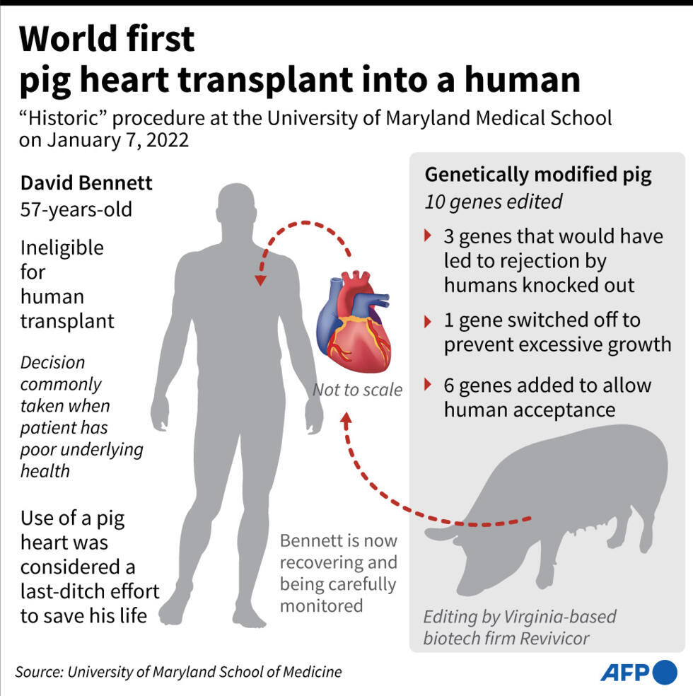Pakistan proud of pig-to-human heart transplant pioneer