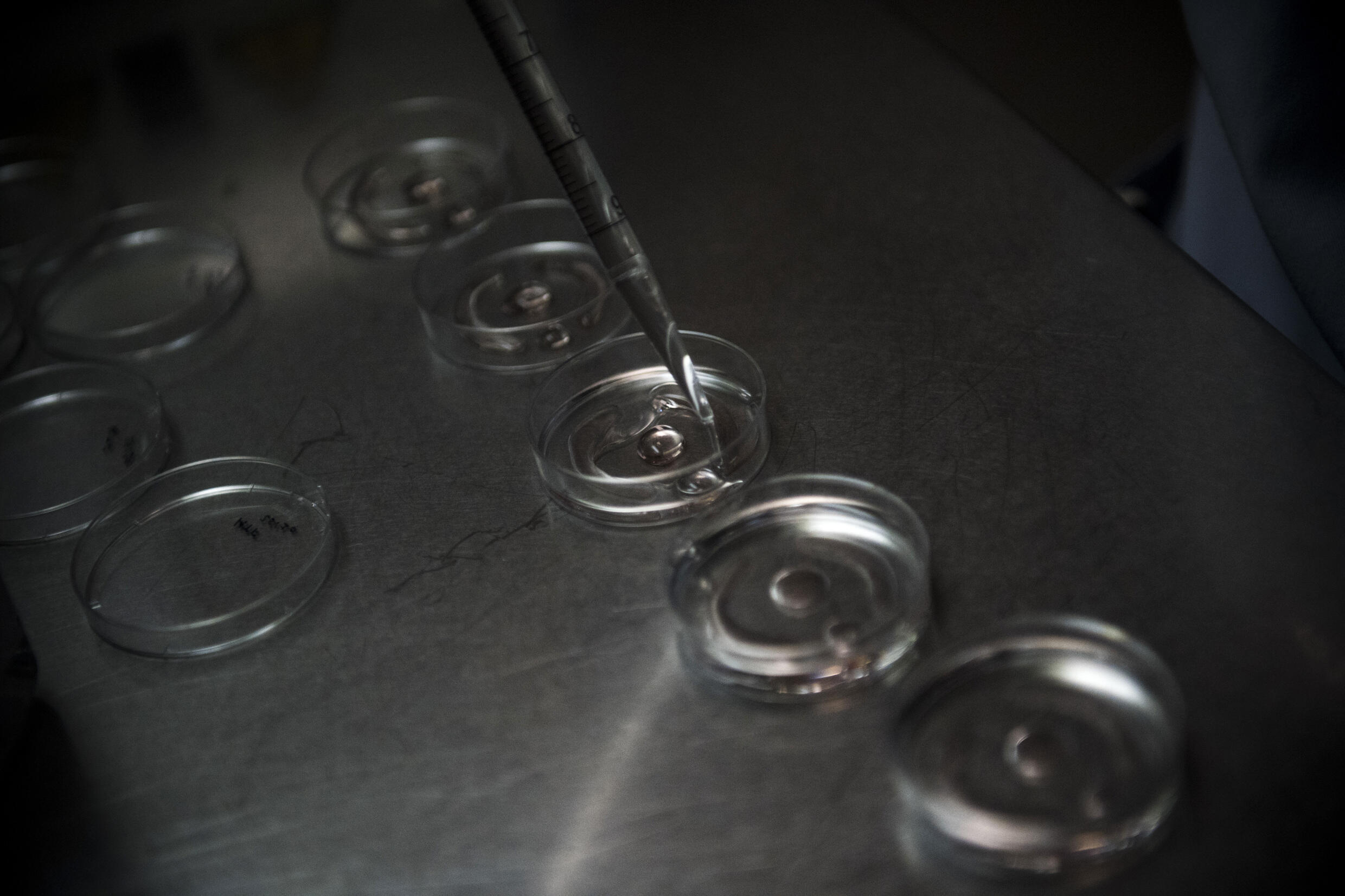 De la ponction à l'embryon, dans un centre de PMA entre espoirs et doutes