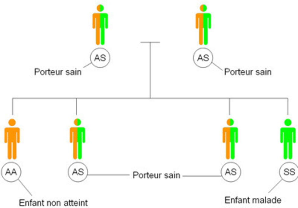 La drépanocytose, une maladie en passe de devenir un enjeu de santé ...