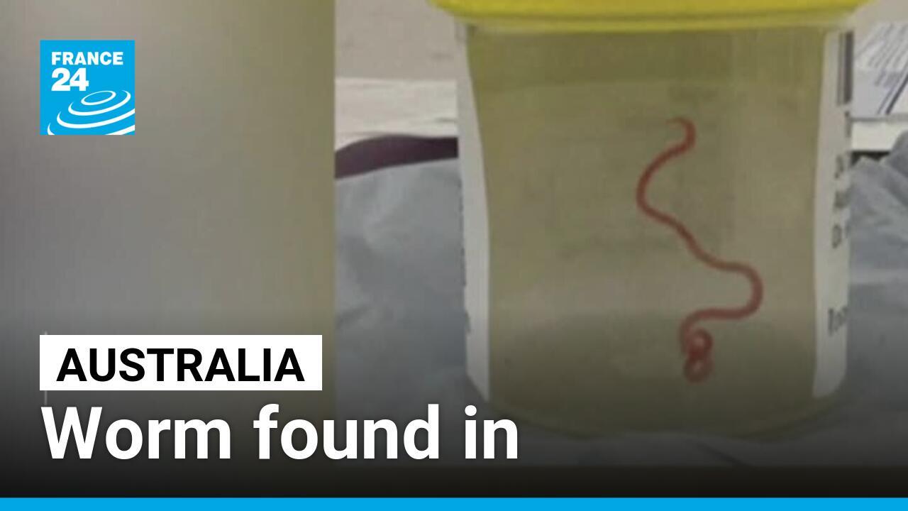 Worm found in woman's brain: 8cm creature was living in Australian ...