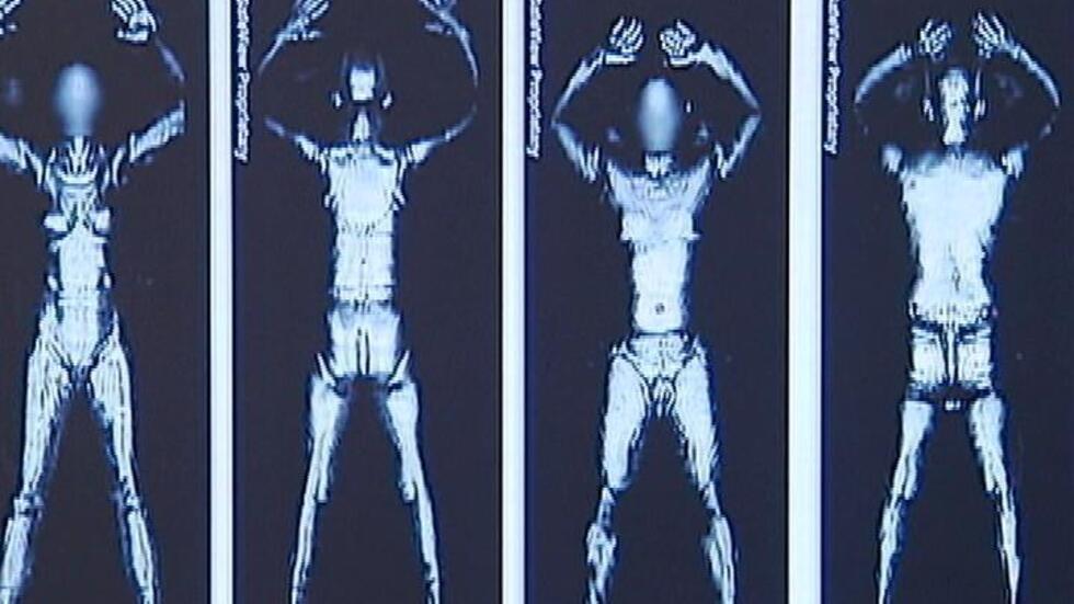 Le scanner corporel testé à Roissy - Focus
