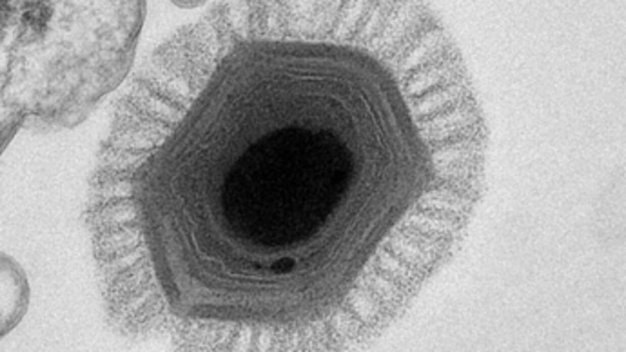 Giant virus 'opens Pandora's box', says French team