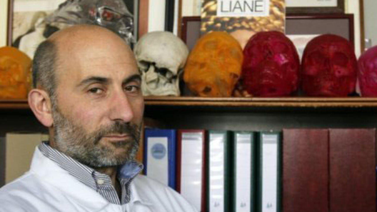 Doctors in France claim 'world first' face transplant