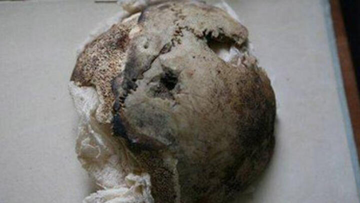 Russia says 'Hitler skull' is authentic