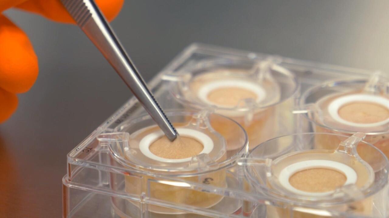 Recycling human skin: An alternative to animal testing? - Down to Earth ...