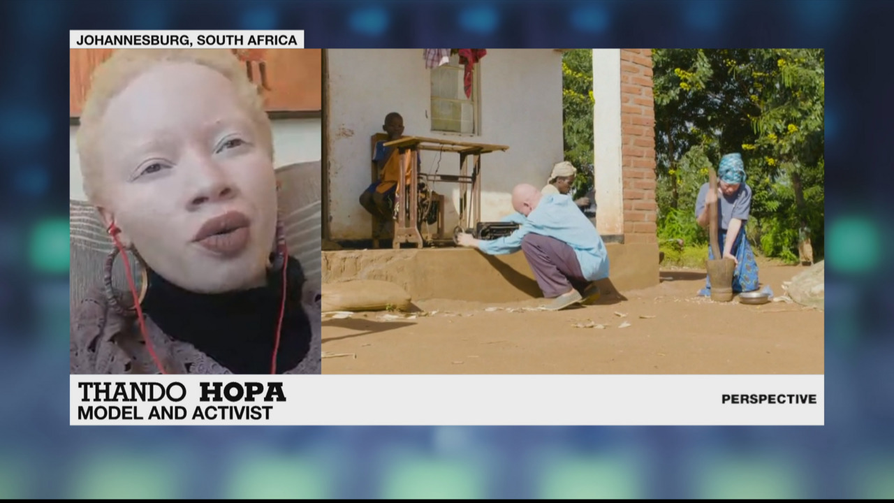 South African model Thando Hopa on representing albinism in a positive ...