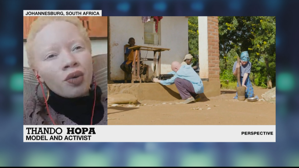 South African model Thando Hopa on representing albinism in a positive ...
