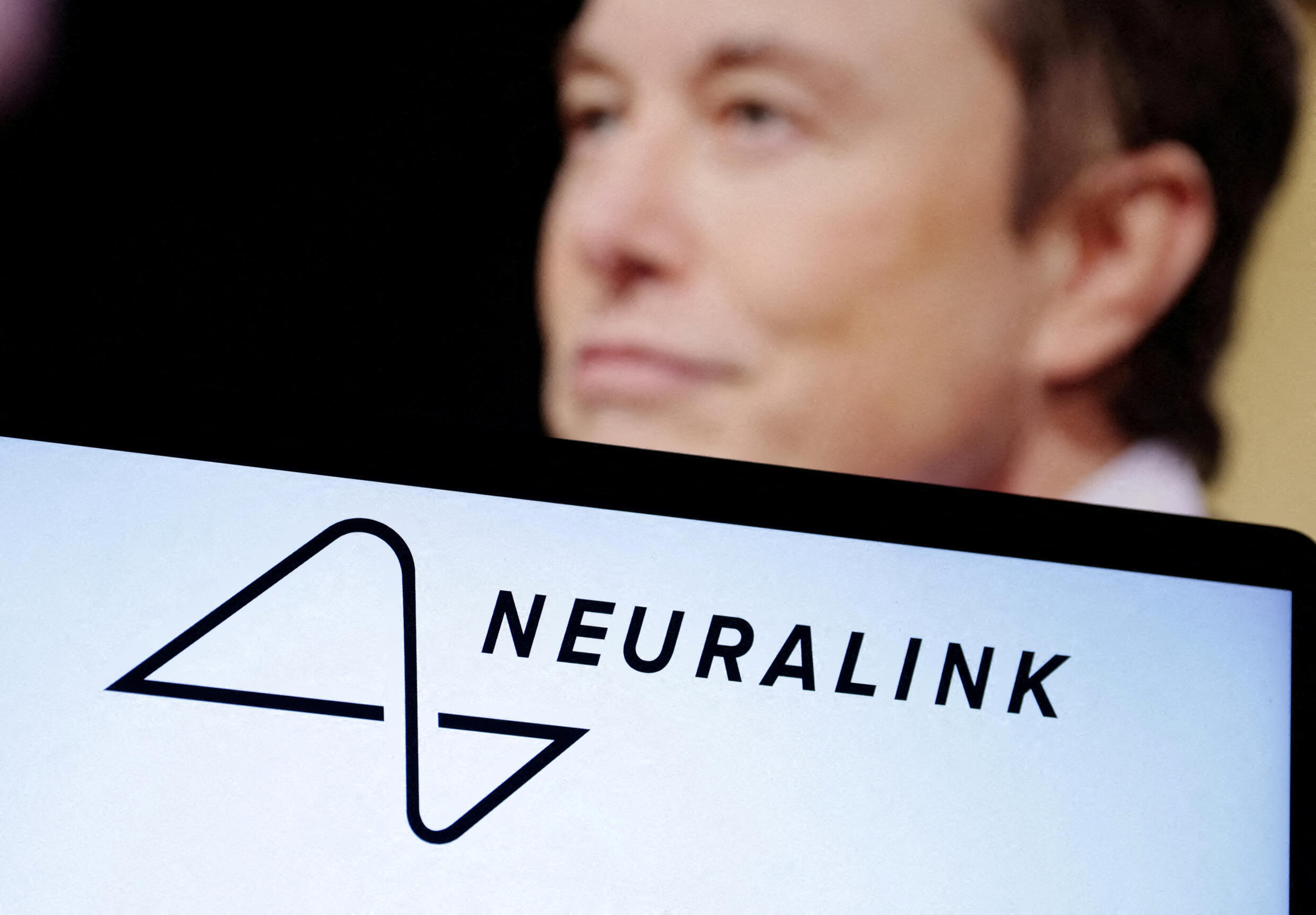 Neuralink, la start-up d'Elon Musk, pose à son tour son premier implant cérébral