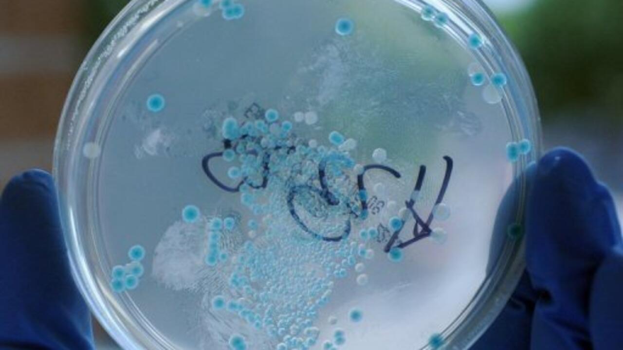 Beansprouts likely cause of E.coli outbreak - France 24