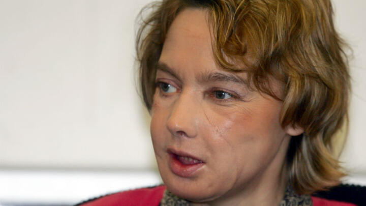 Frenchwoman who received first-ever face transplant dies