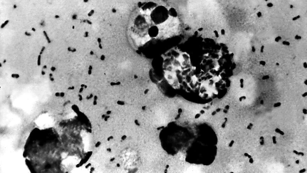 Plague outbreak kills 40 in Madagascar