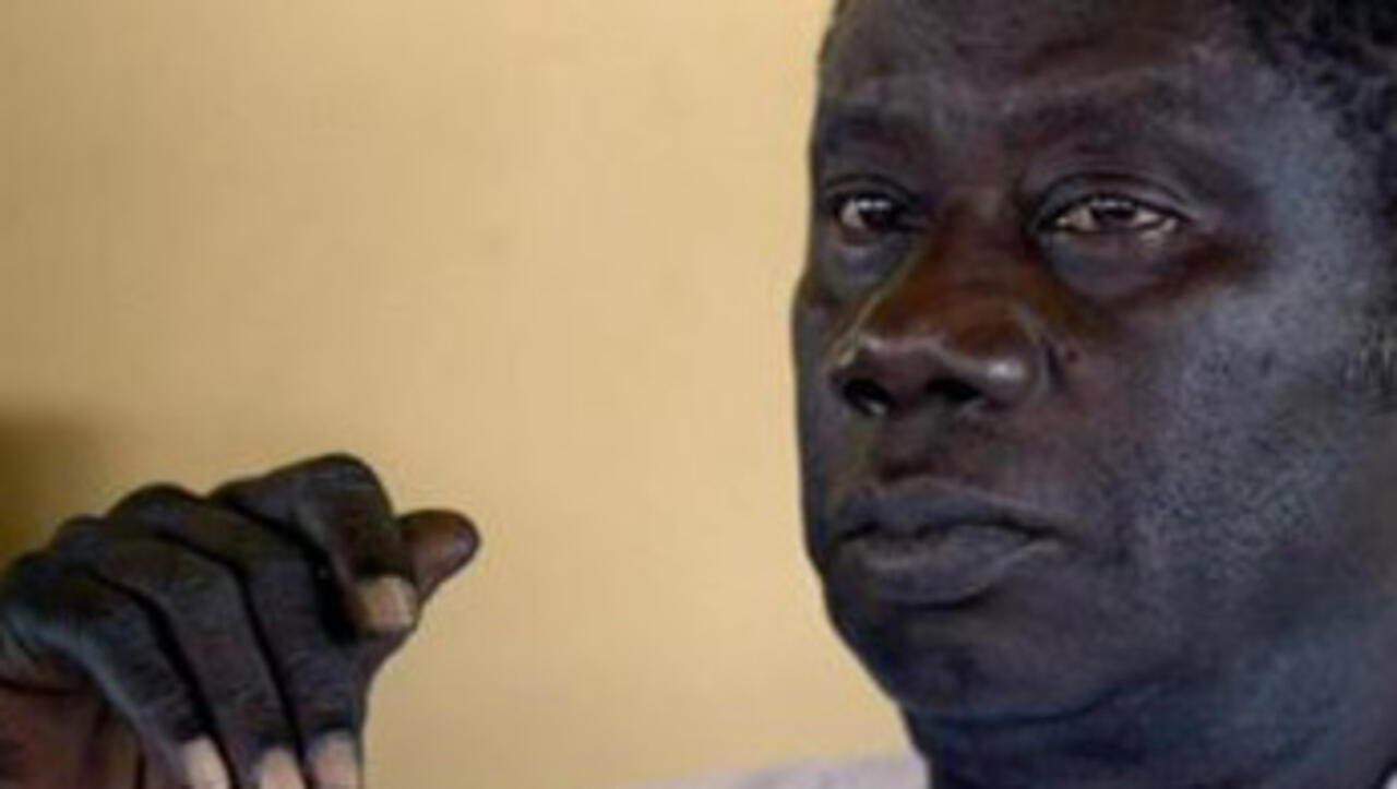 Le président Lansana Conté est mort après 24 ans au pouvoir