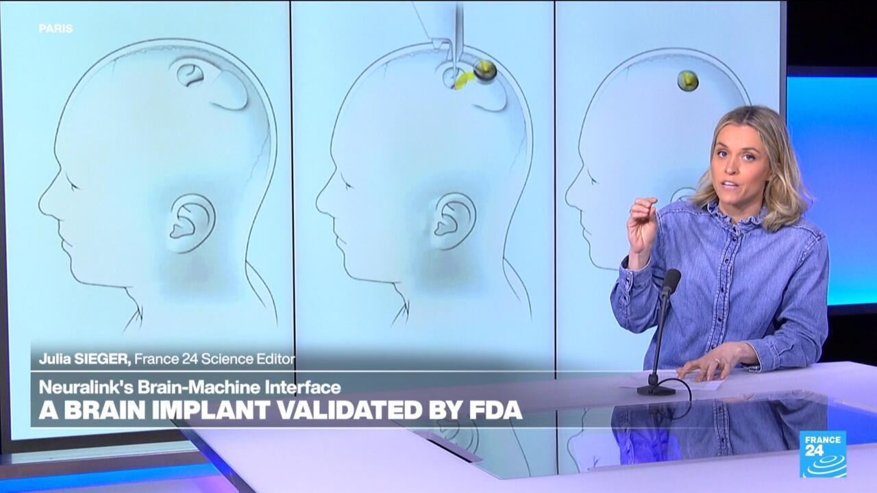 US FDA approves Neuralink's brain chip implant for second patient - Science
