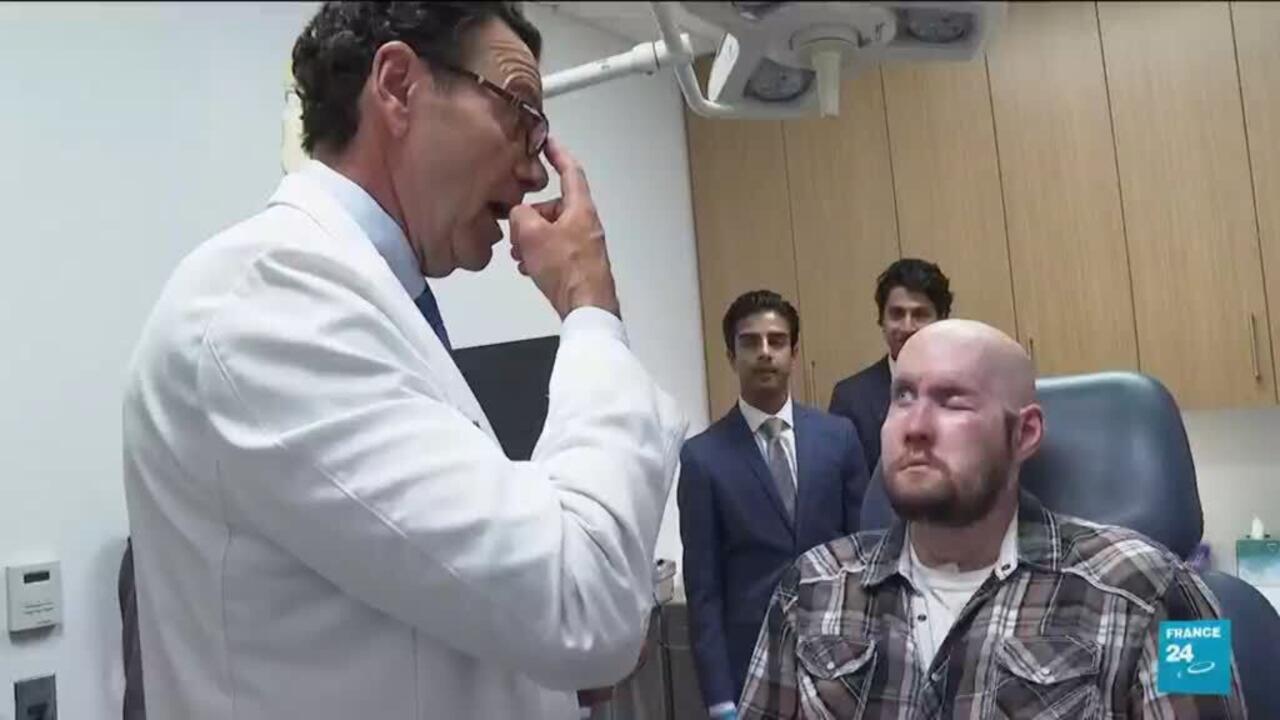 US surgeons perform world's first whole eye transplant - France 24